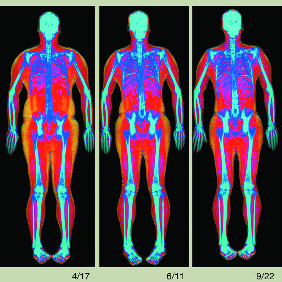 Body Composition Scan